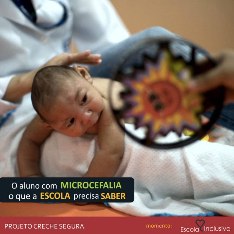 16 recomendações para estimulação de crianças com microcefalia | Creche ...